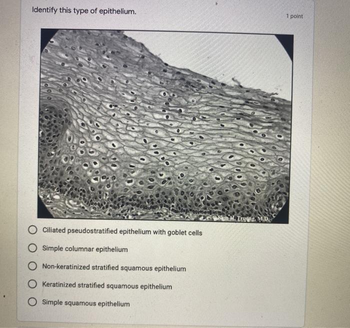 Solved Identify this type of epithelium. 1 point M.D. O | Chegg.com