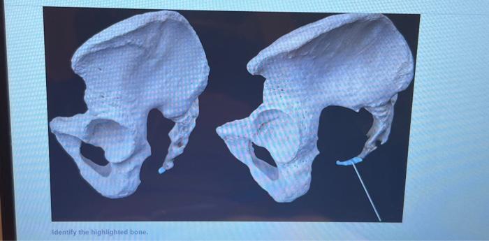 Solved Identify the highlighted bone. | Chegg.com