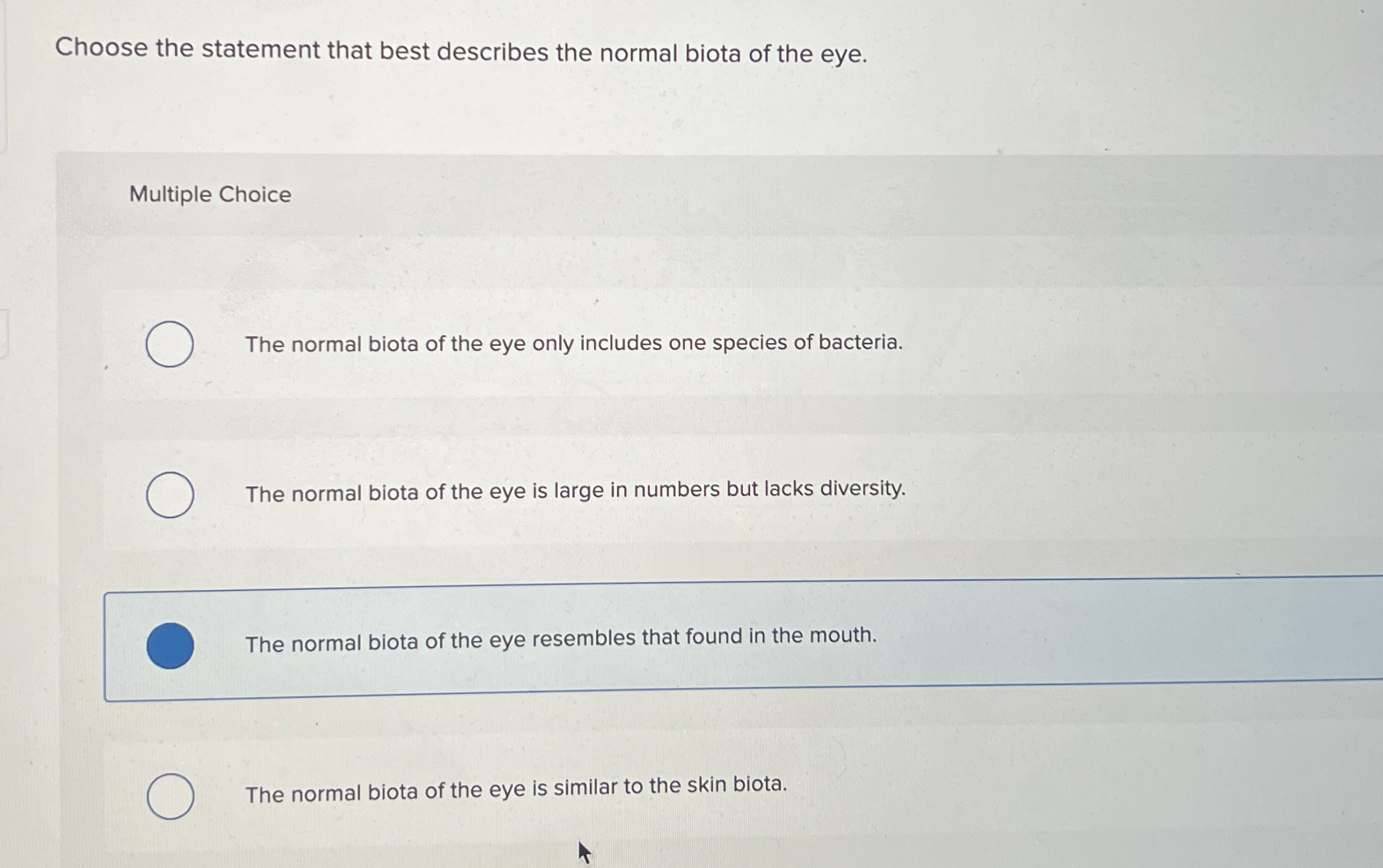 Solved Choose the statement that best describes the normal | Chegg.com
