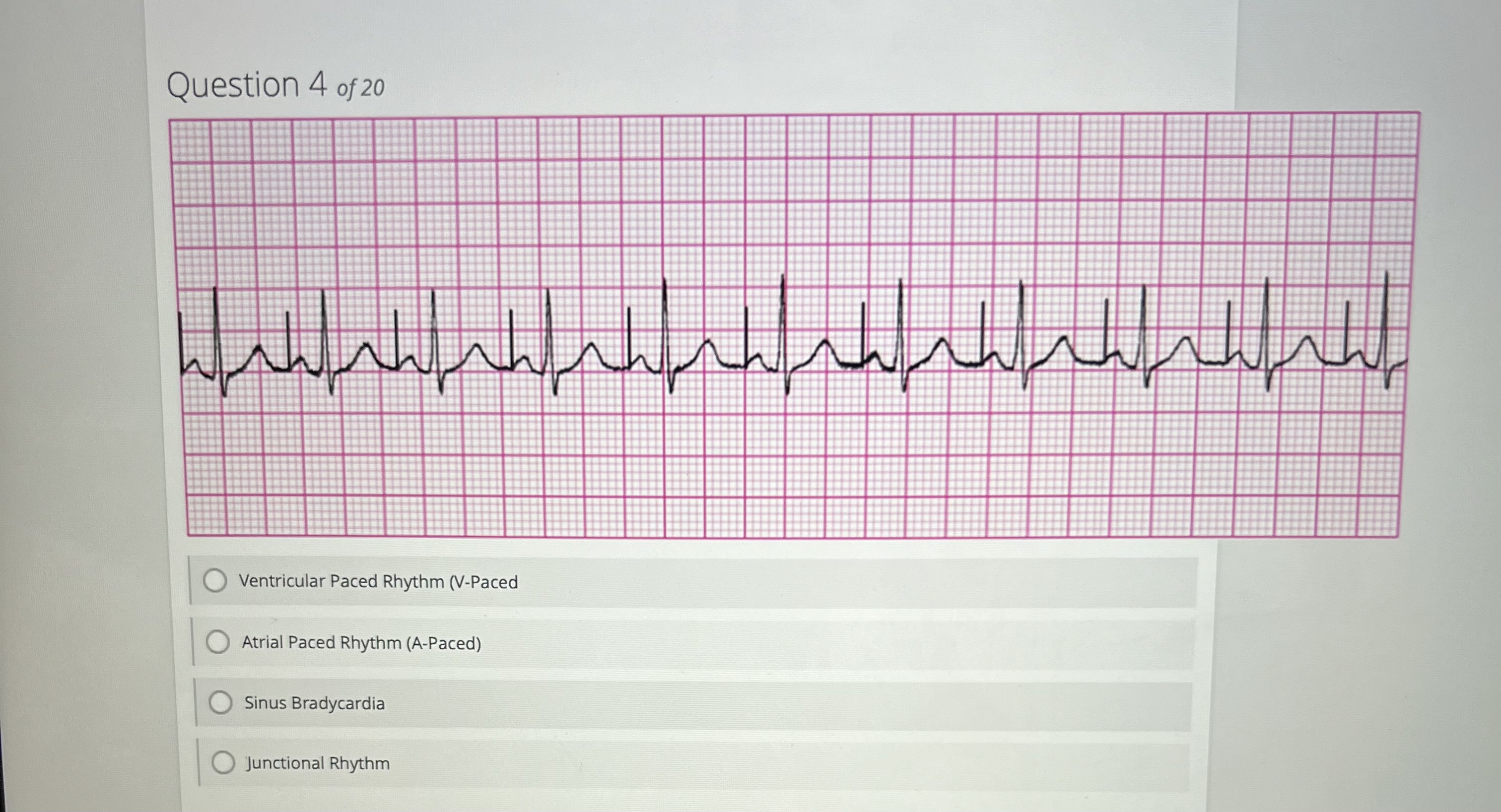 Solved Question 4 ﻿of 20A. ﻿Ventricular paced rhythym | Chegg.com