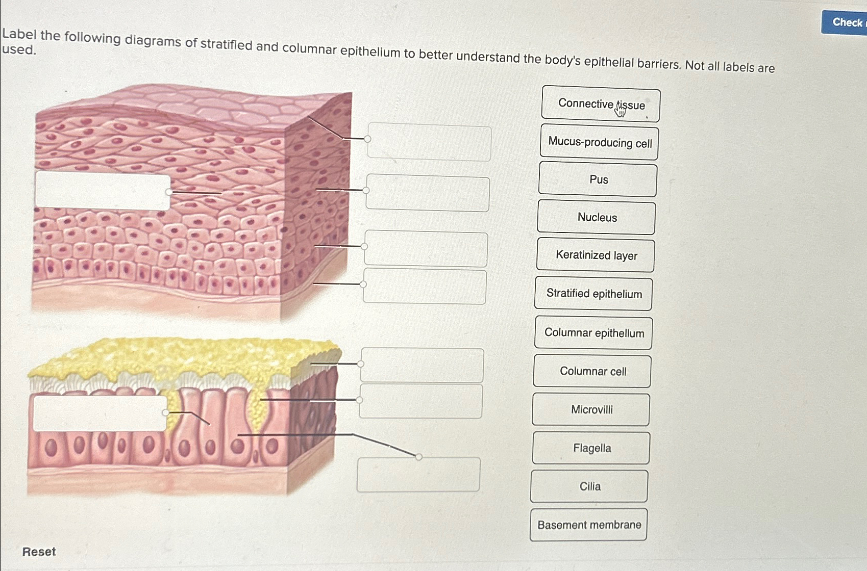Solved Label the following diagrams of stratified and | Chegg.com