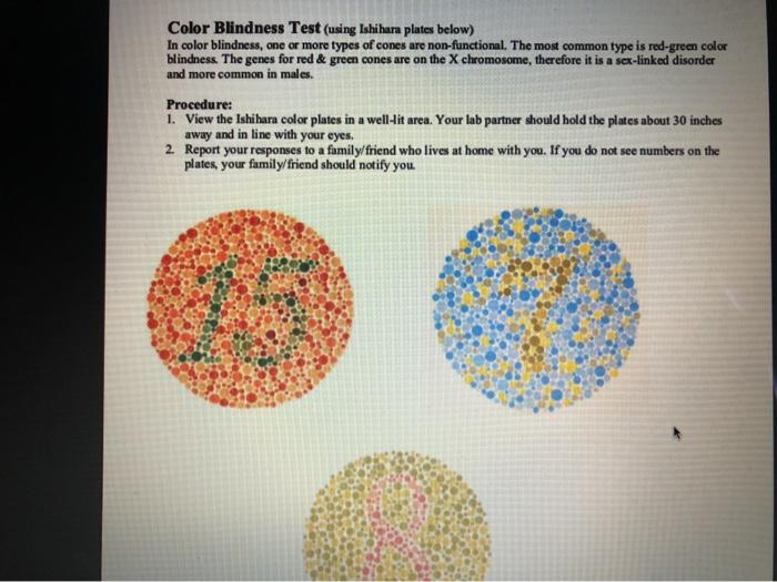 Lab 5 - Vision In this lab you will discuss the | Chegg.com