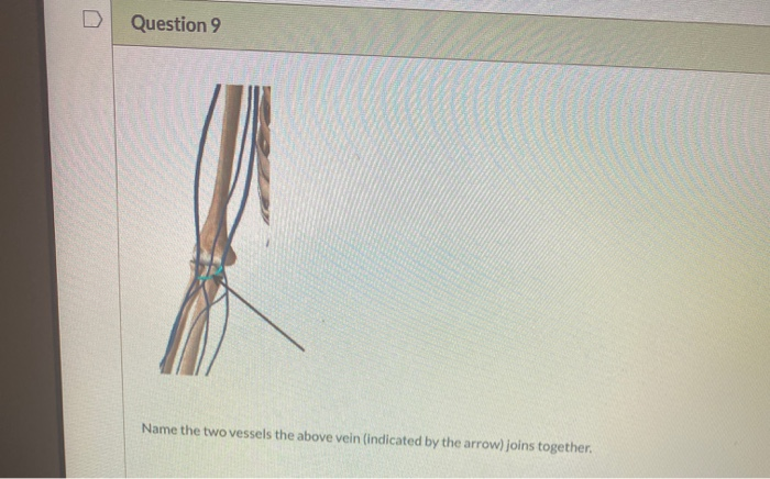Solved Question 9 Name the two vessels the above vein | Chegg.com