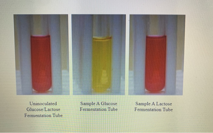 Solved Rey aliterences between select Gram-negative rods | Chegg.com