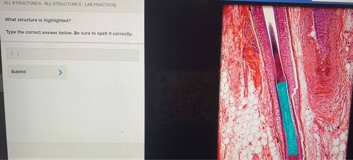 Solved ALL STRUCTURES ALL STRUCTURES LAB PRACTICAL What | Chegg.com