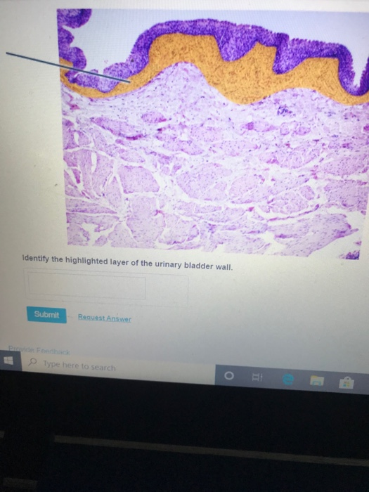 Solved Identify the highlighted layer of the urinary bladder | Chegg.com