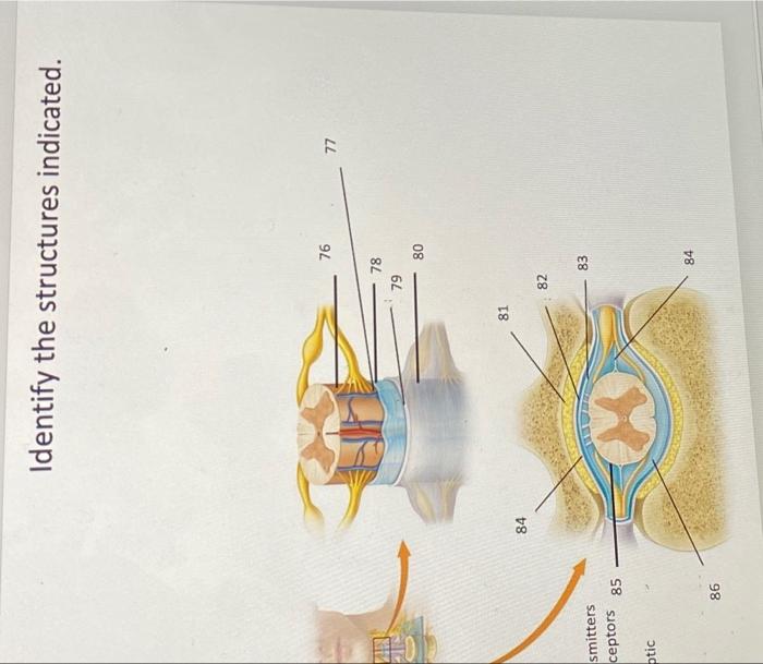 Solved Identify the structures indicated, (a)64Identify the | Chegg.com
