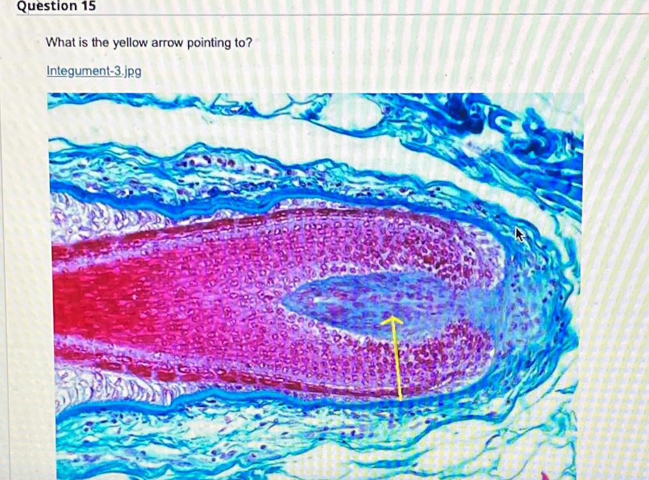 Question 15What is the yellow arrow pointing | Chegg.com