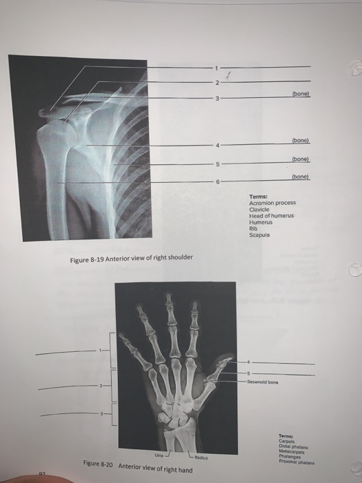 Solved Coronoid process Radius -Head of ulna Styloid process | Chegg.com