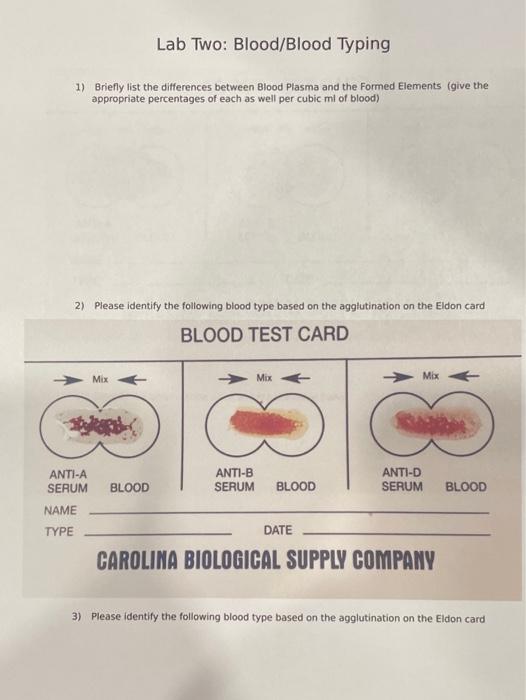 Solved Lab Two: Blood/Blood Typing 1) Briefly list the | Chegg.com
