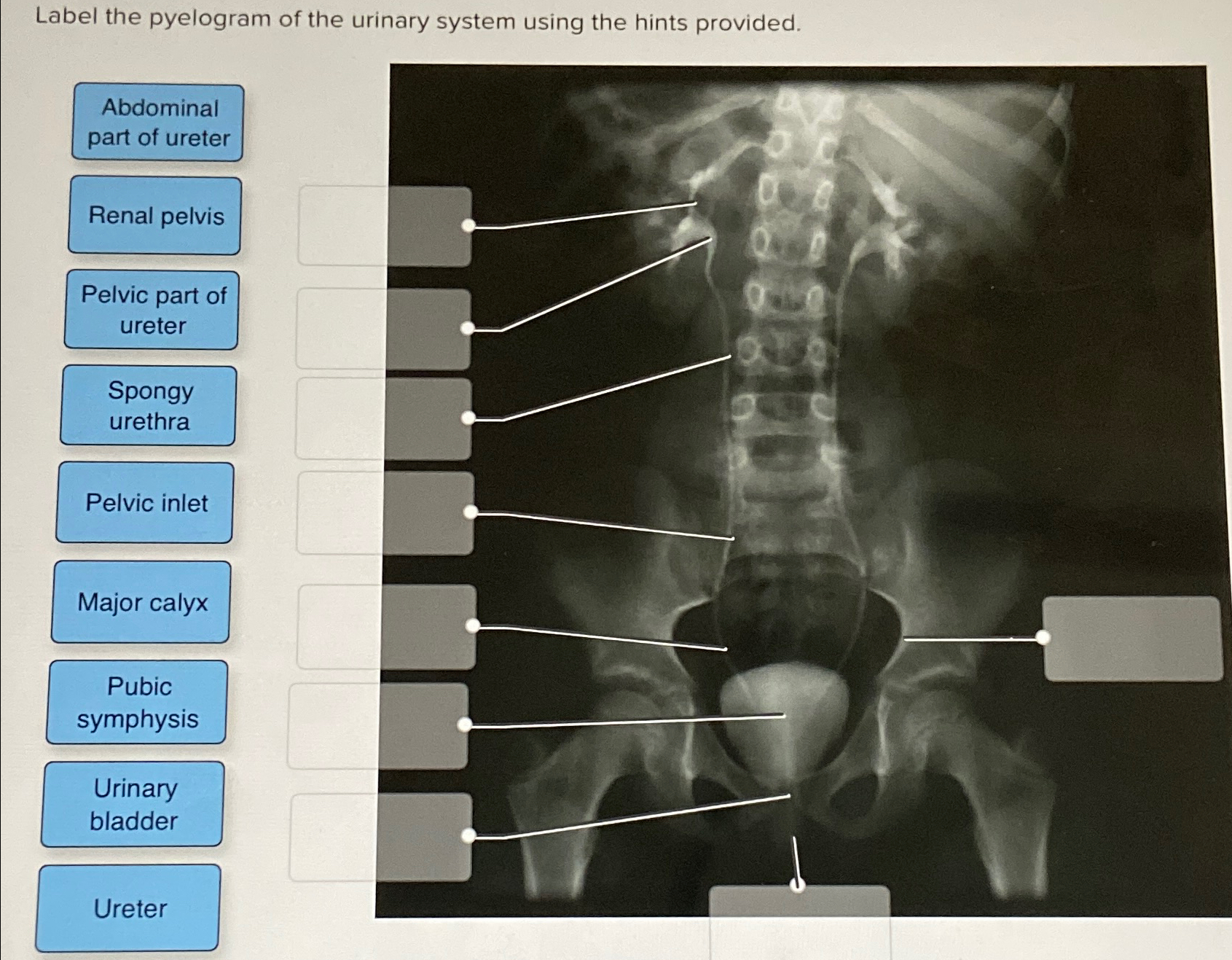 Solved Label the pyelogram of the urinary system using the | Chegg.com