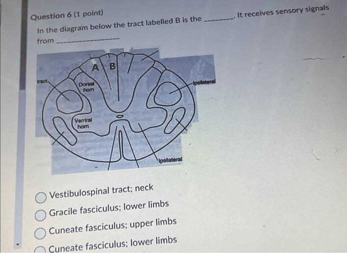 Solved Question 6 (1 point) In the diagram below the tract | Chegg.com