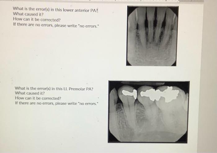 What is the error(s) in this lower anterior PA? What | Chegg.com