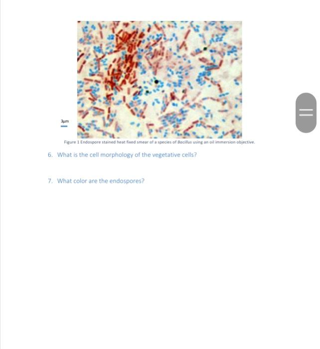 Solved um Figure 1 Endospore stained heat fixed smear at a | Chegg.com