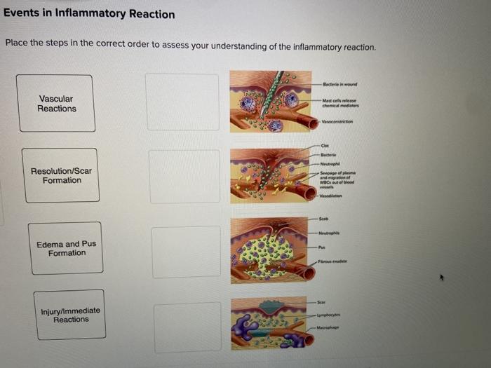 Solved Events in Inflammatory Reaction Place the steps in | Chegg.com