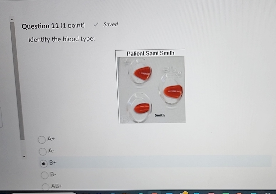 Solved Question 11 (1 ﻿point) ﻿SavedIdentify the blood | Chegg.com