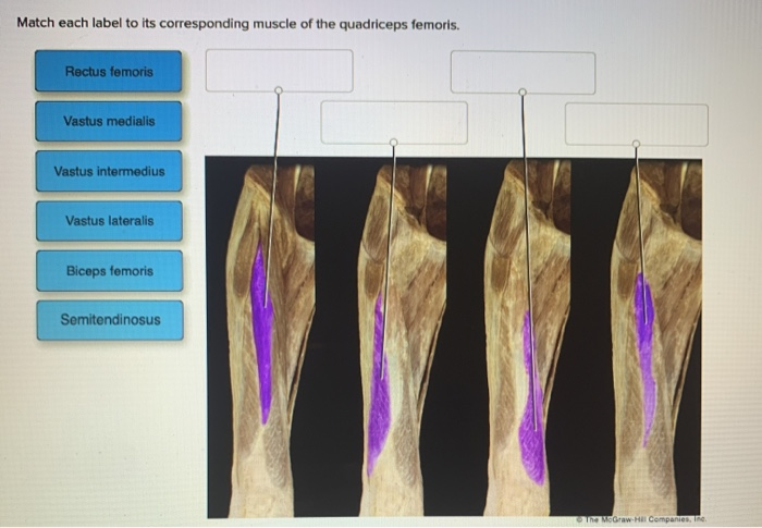 Solved Correctly label the following muscles of the | Chegg.com