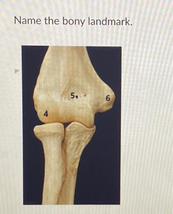 Solved Name the bony landmark. | Chegg.com