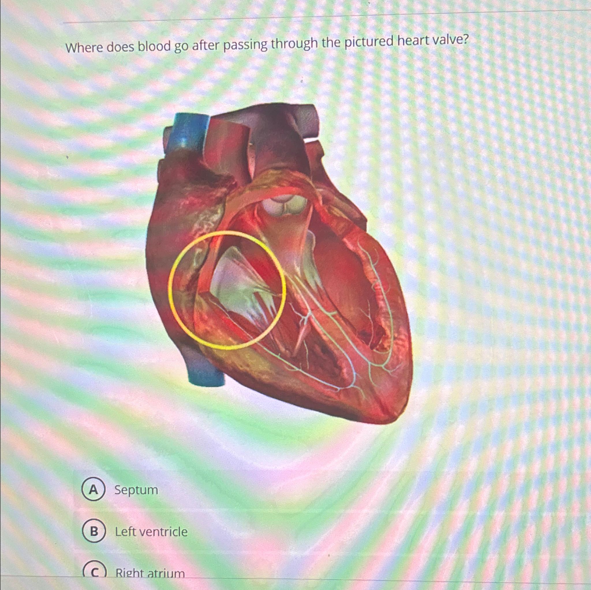 Solved Where does blood go after passing through the | Chegg.com