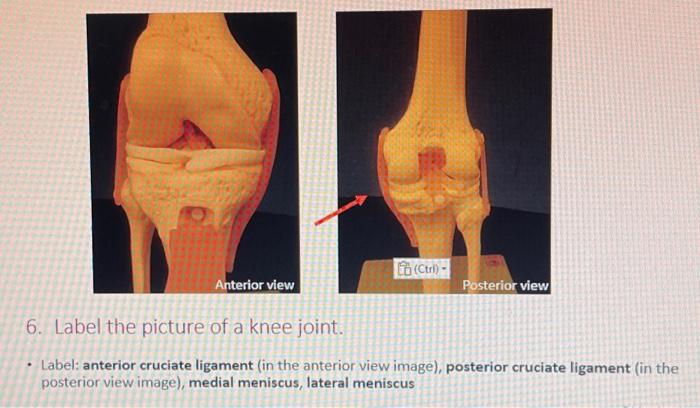 Solved 6. Label the picture of a knee joint. - Label: | Chegg.com