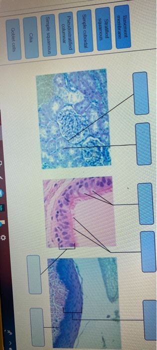 Solved Basement membrane Stratified squamous Simple cuboidal | Chegg.com