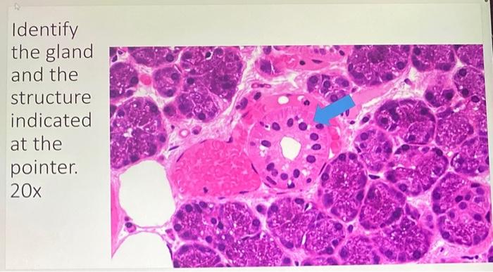 Solved Identify the gland and the structure indicated at the | Chegg.com