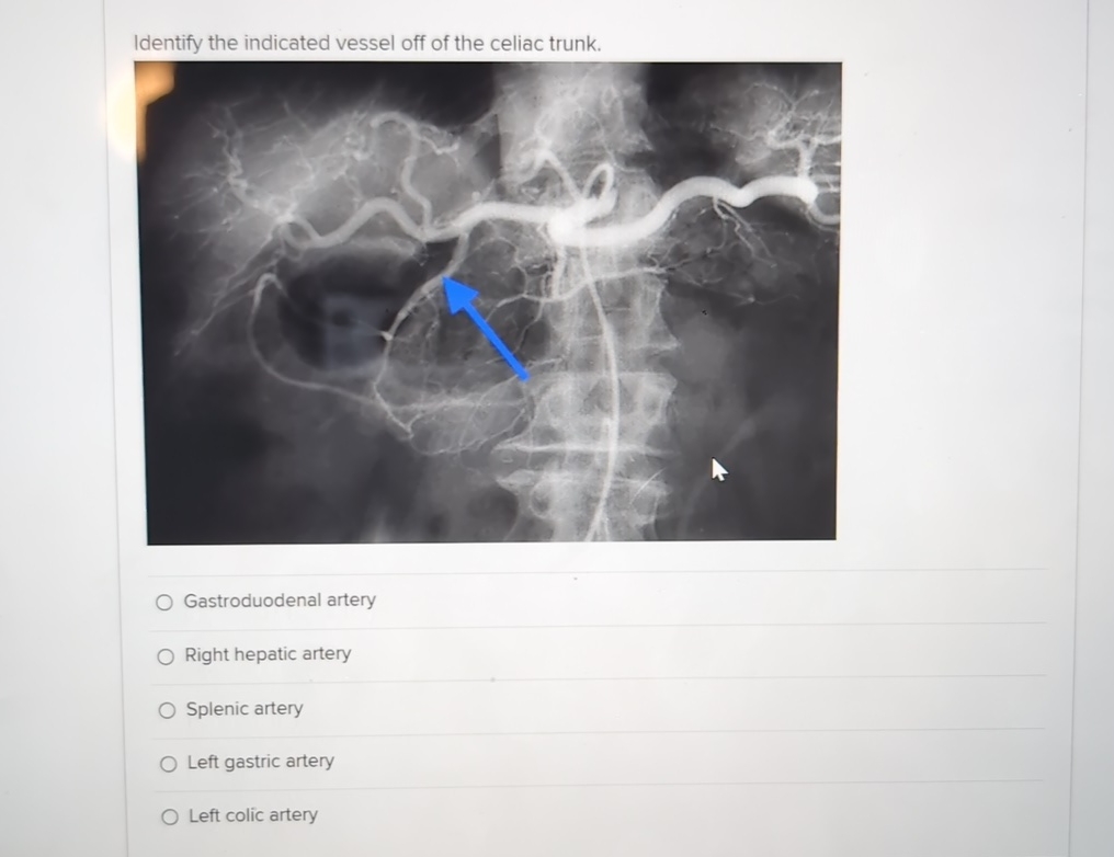 Solved Identify the indicated vessel off of the celiac | Chegg.com