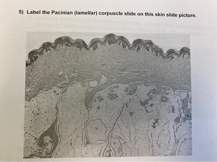 Solved 5) Label the Pacinian (lamellar) corpuscle slide on | Chegg.com