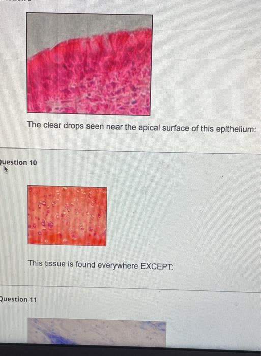 Solved Question 1 What type of tissue is seen here? Question | Chegg.com