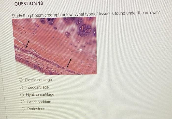 Solved QUESTION 18 Study the photomicrograph below. What | Chegg.com