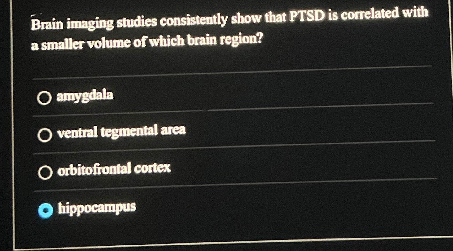 Solved Brain imaging studies consistently show that PTSD is | Chegg.com