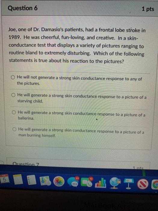 Solved Question 6 1 pts Joe, one of Dr. Damasio's patients, | Chegg.com
