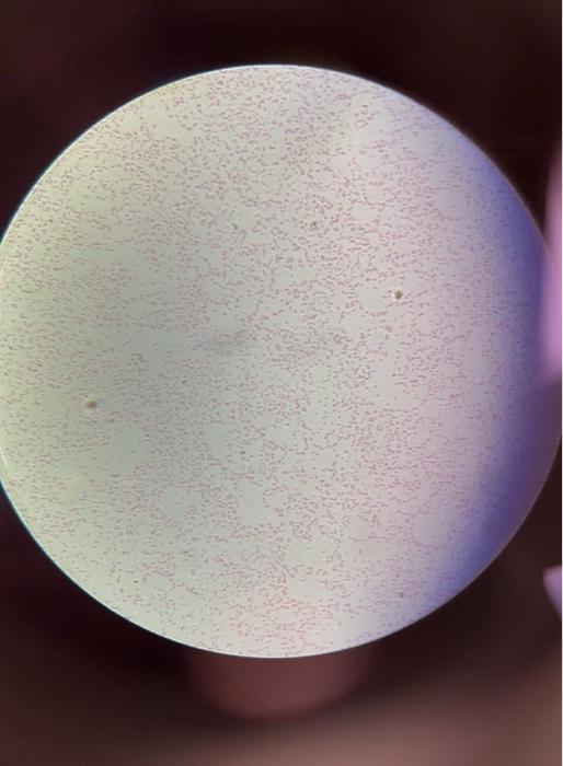 Solved Is this a positive endospore or a negative endospore | Chegg.com