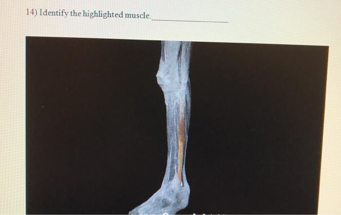 Solved 16) Identify the highlighted muscle. 15) Identify | Chegg.com