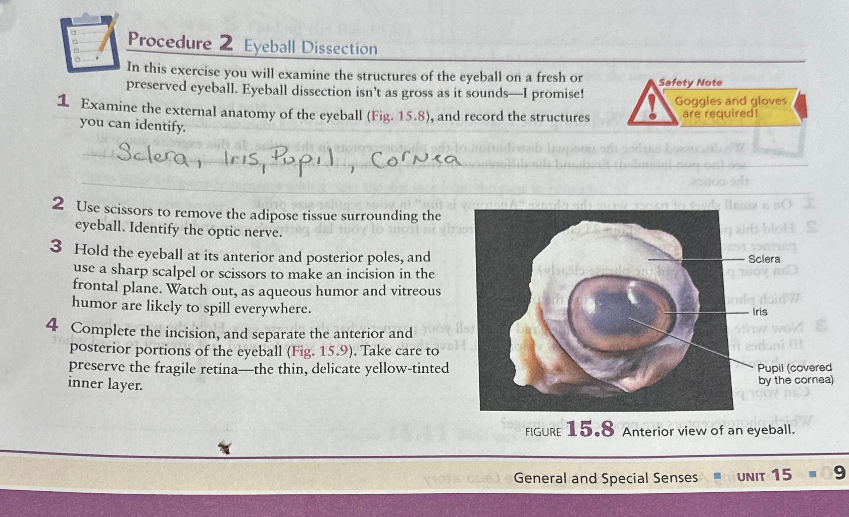 Solved Procedure 2 ﻿Eyeball DissectionIn this exercise you | Chegg.com