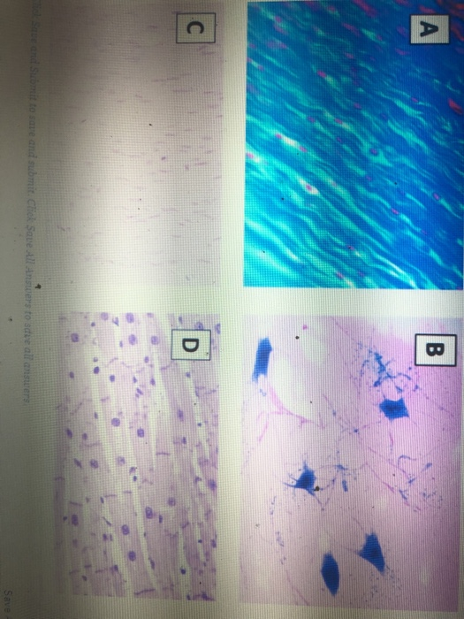 Solved с adipose loose connective tissue areolar loose | Chegg.com