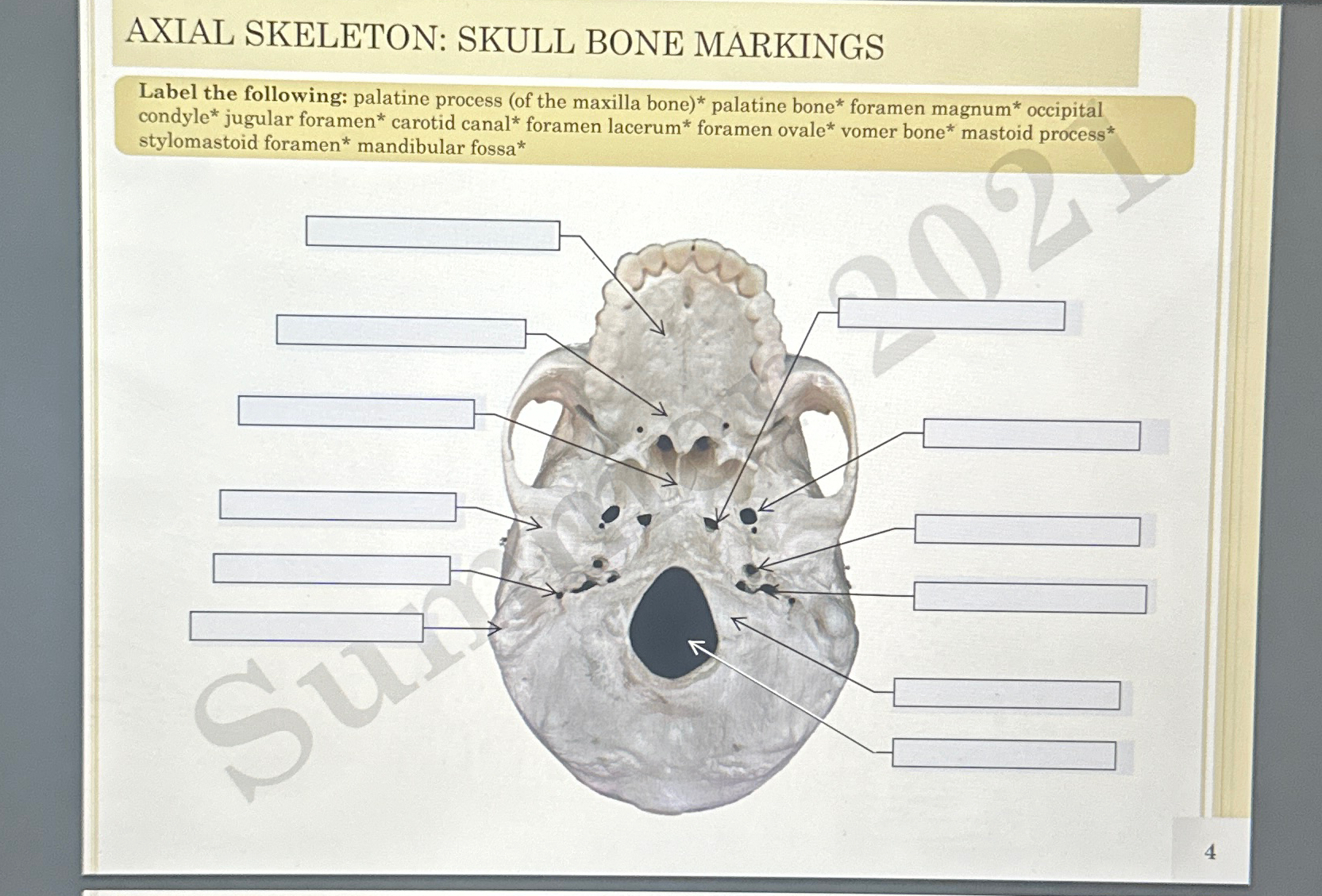 Solved AXIAL SKELETON: SKULL BONE MARKINGSLabel the | Chegg.com