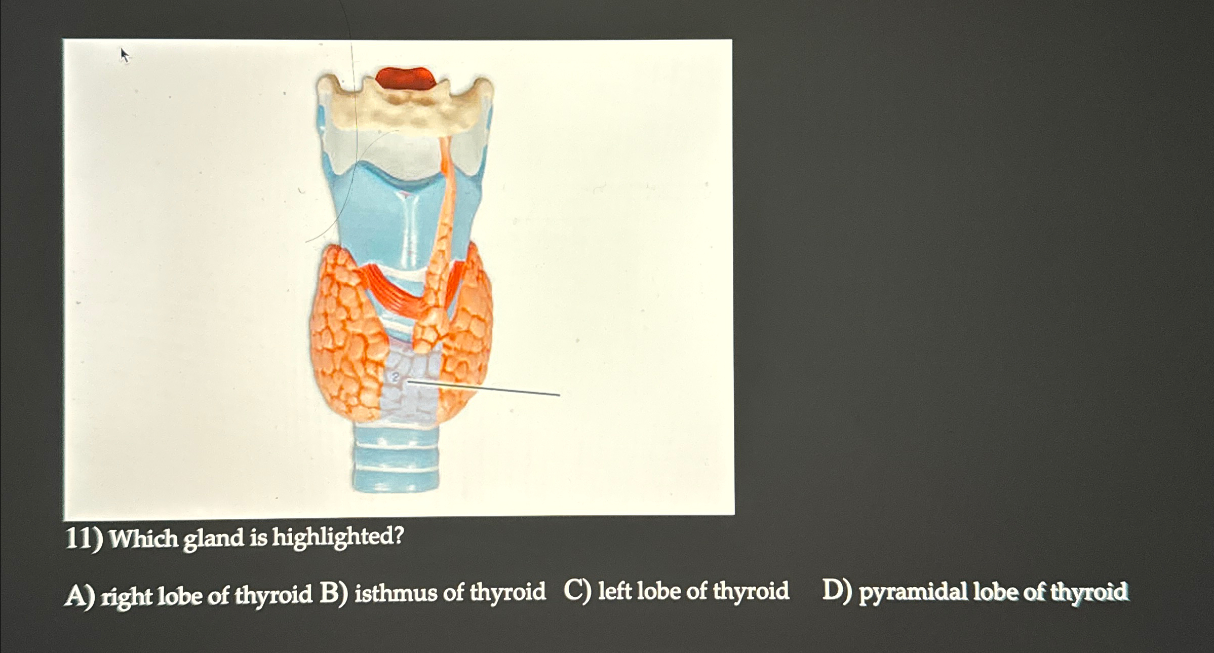 Solved Which gland is highlighted?A) ﻿right lobe of thyroid | Chegg.com