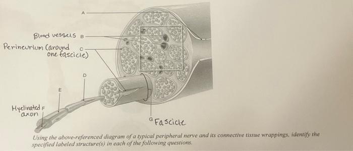 Solved Using the above-referenced diagram of a typical | Chegg.com