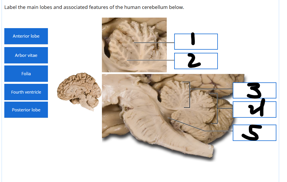 Solved Label the main lobes and associated features of the | Chegg.com