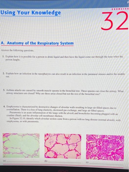 Solved EXERCI Using Your Knowledge 32 A. Anatomy of the | Chegg.com