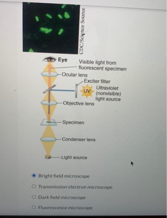 Solved Eye Visible light from fluorescent specimen - Ocular | Chegg.com