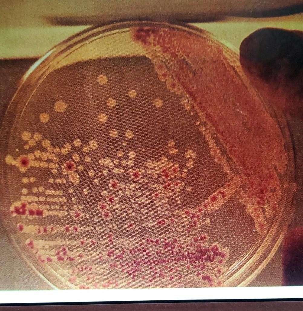 Solved PART A: Isolation of Discrete Colonies from a Mixed | Chegg.com