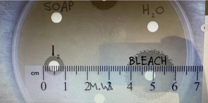 Solved measure the diameter of the zone of inhibition in | Chegg.com