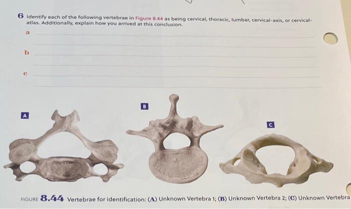 Solved 6 Identify each of the following vertebrae in Figure | Chegg.com