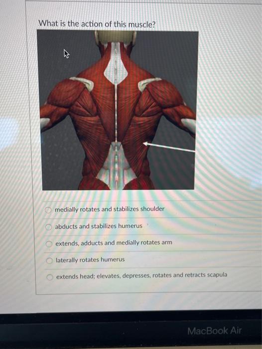 Solved What is the action of this muscle? medially rotates | Chegg.com