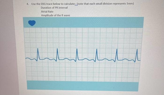 Solved 2. Trace the movement of a single red blood cell from | Chegg.com