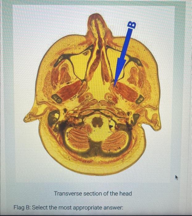 Solved Transverse section of the head Flag B: Select the | Chegg.com
