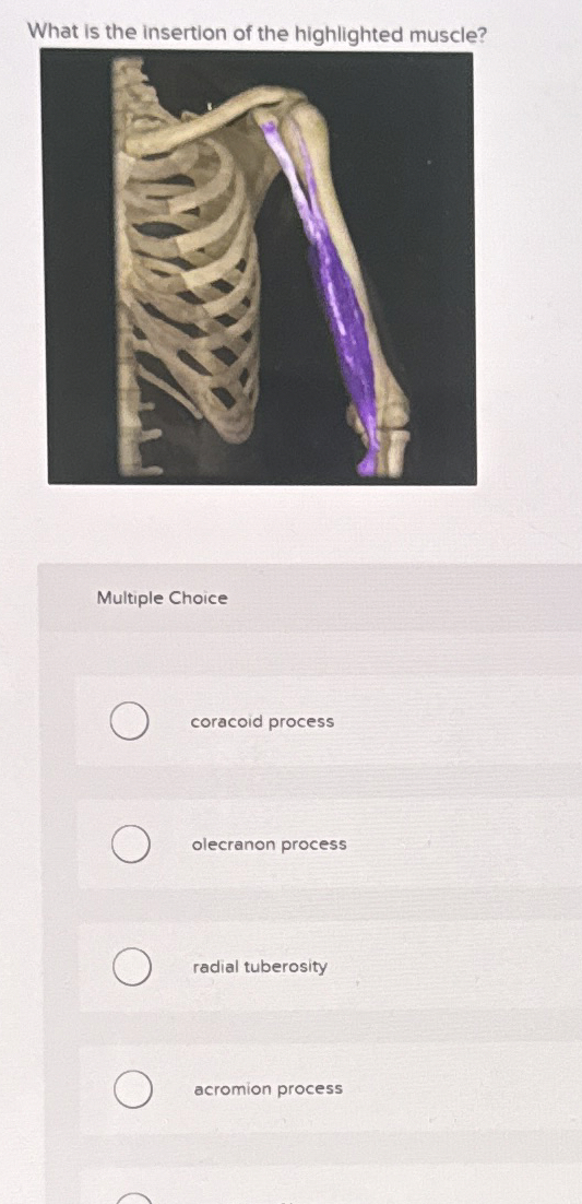 Solved What is the insertion of the highlighted | Chegg.com