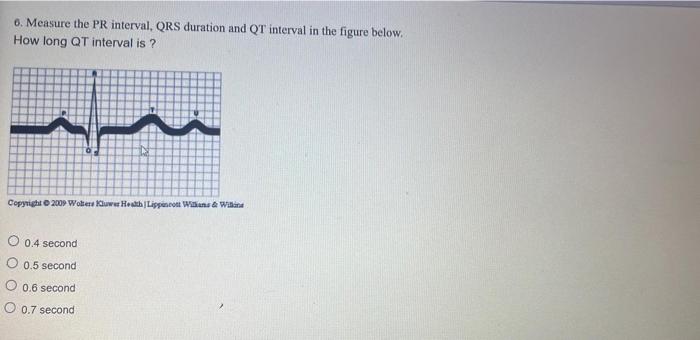 Solved 6. Measure the PR interval, QRS duration and QT | Chegg.com